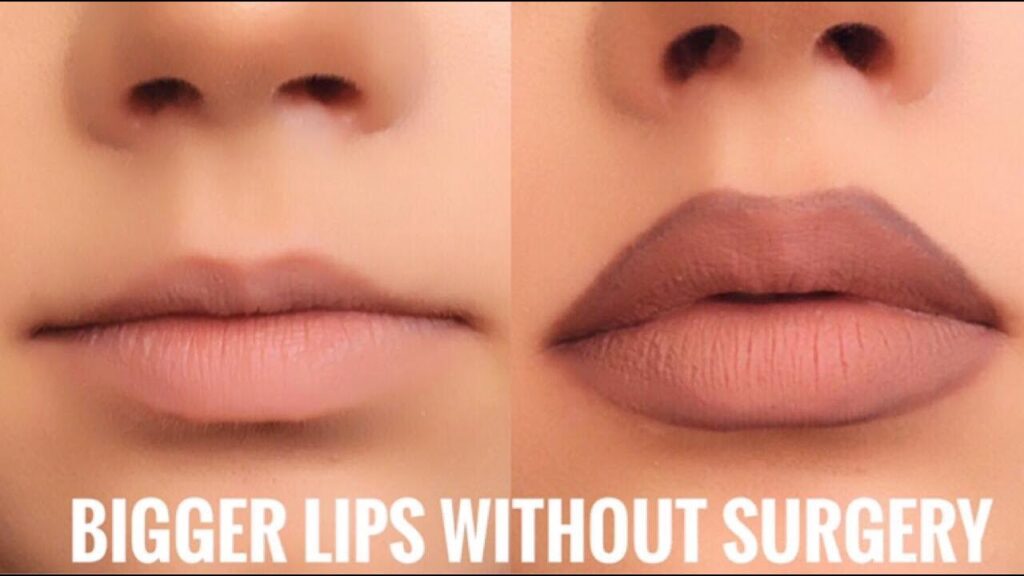 HOW TO GET FULLER AND BETTER LIPS WITHOUT SURGERY - ACU Doctor